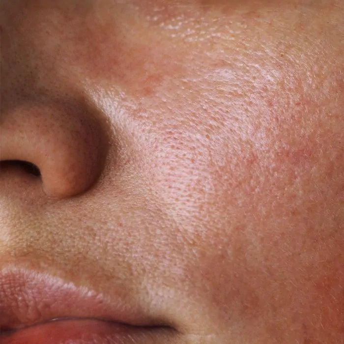 Vette Huid – Skin Boost